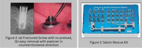 Management Of Fractured Abutment Screws