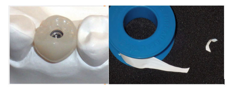 Am I Using The Wrong Material To Fill Screw Access Holes In Screw ...